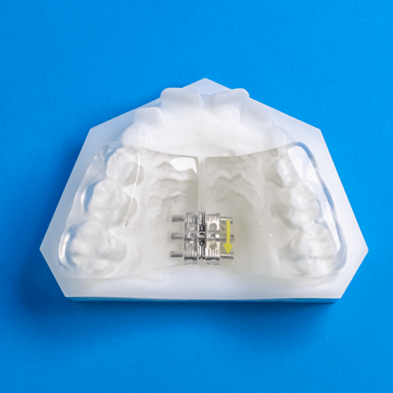 Upper RPE - Specialty Appliances