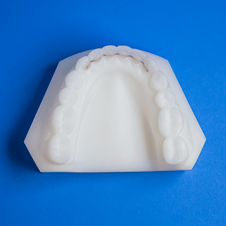 Composite Fixed Lingual Retainers - Specialty Appliances