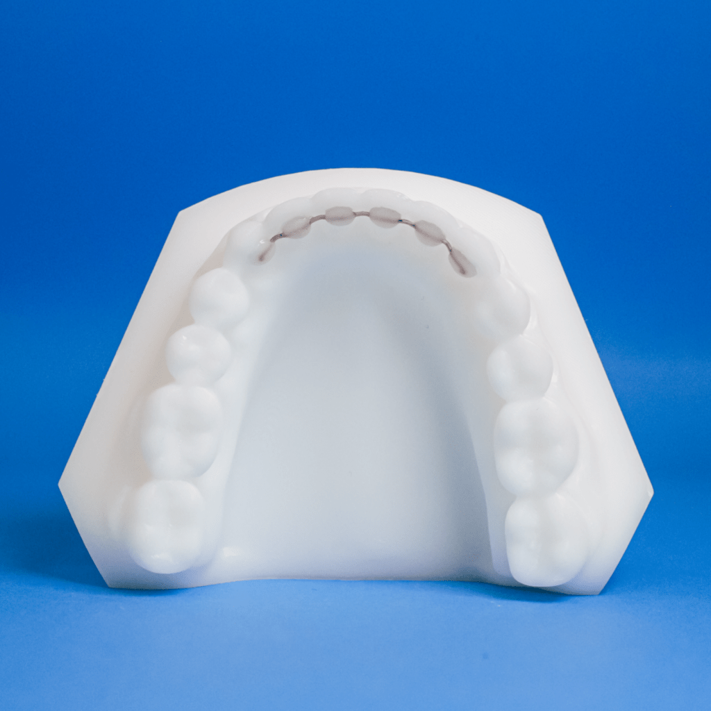 Composite Fixed Lingual Retainers - Specialty Appliances