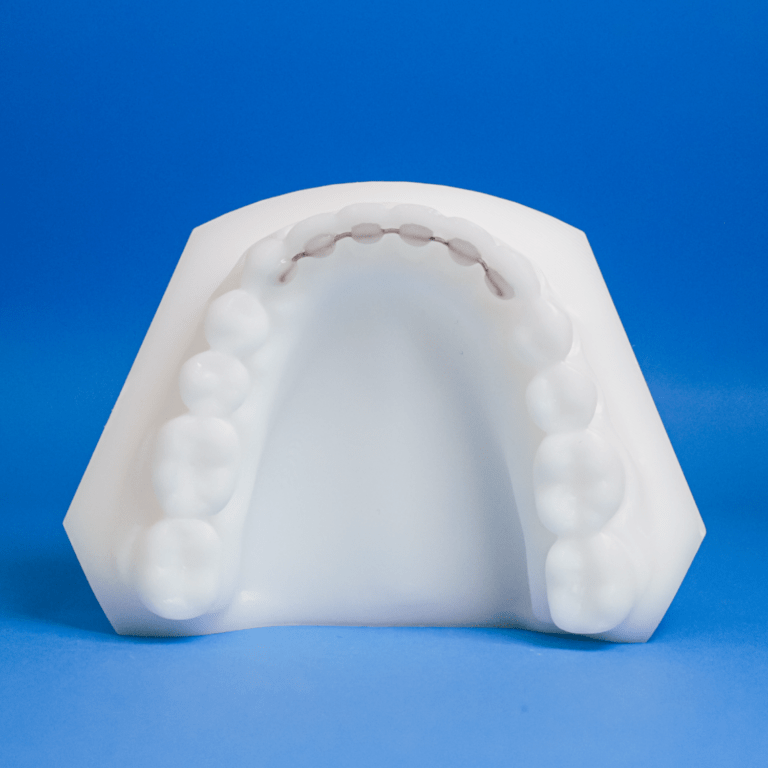 Composite Fixed Lingual Retainers - Specialty Appliances