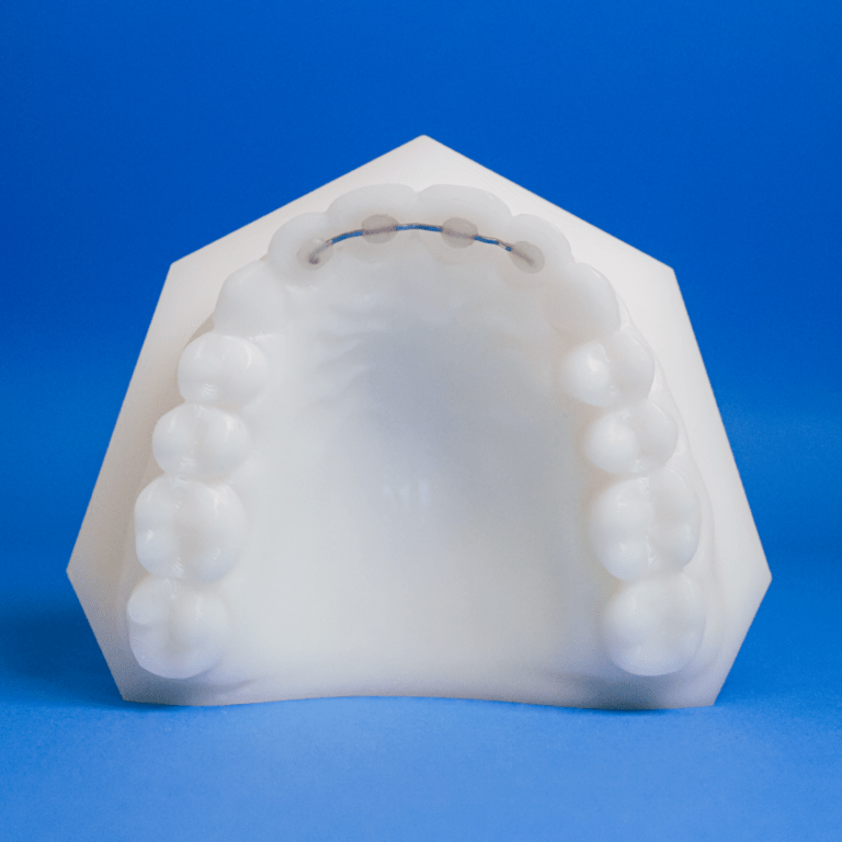 Composite Fixed Lingual Retainers - Specialty Appliances