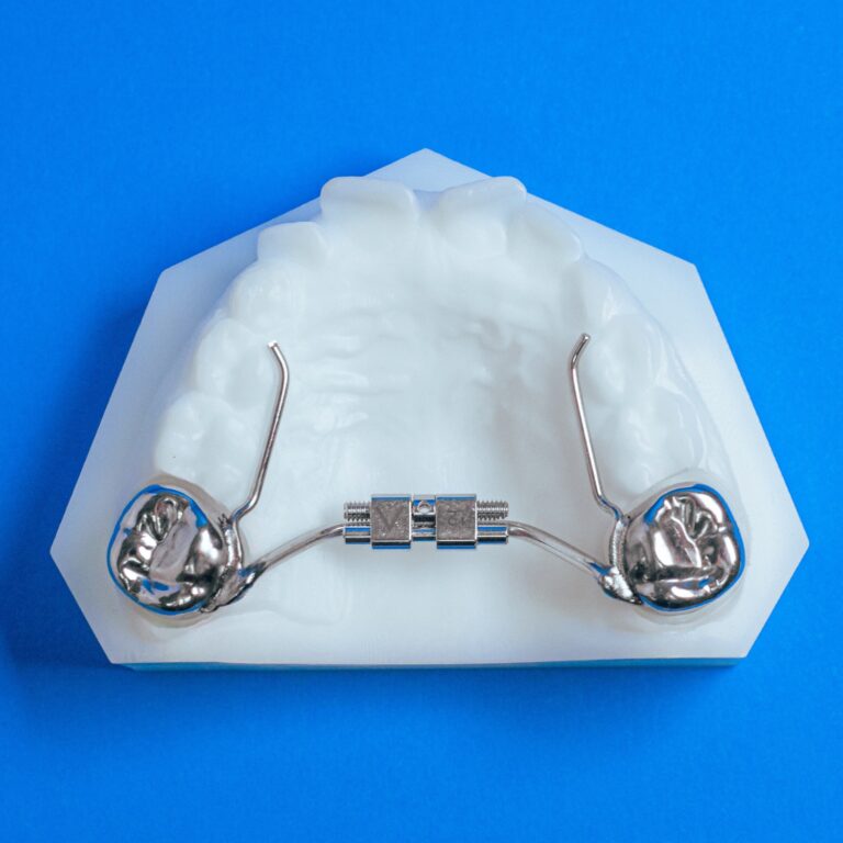 MSE Expander - Specialty Appliances