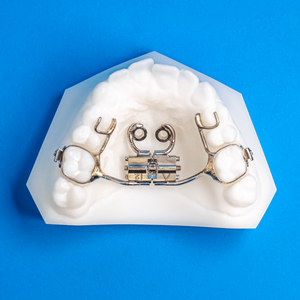 Dentaurum Expander - Specialty Appliances