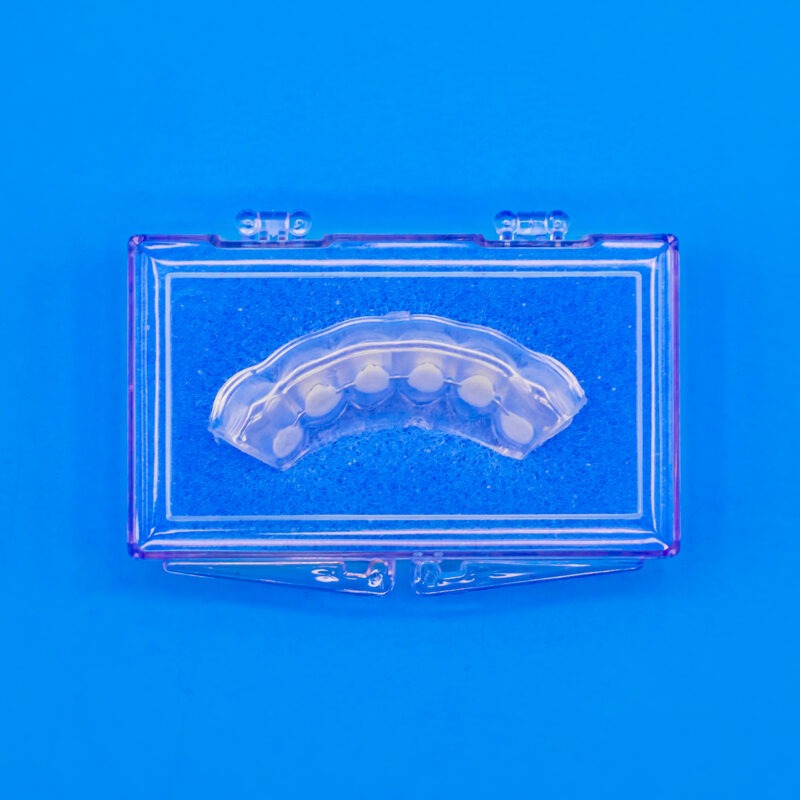 Composite Fixed Lingual Retainer: Bonded Wire Retainer