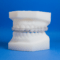 Flat Plane Splint: TMJ and Bruxism Occlusal Appliance