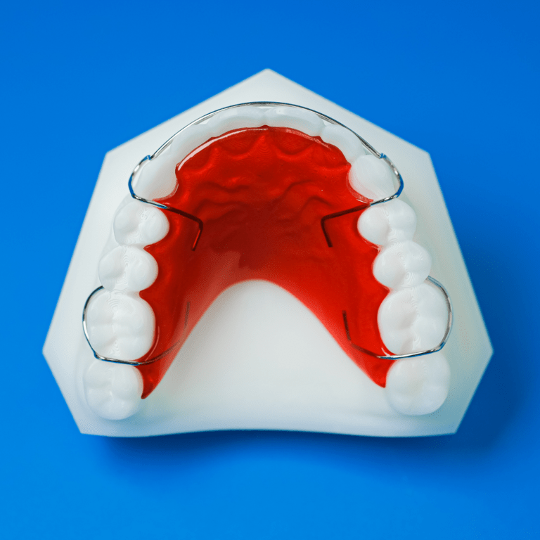 Hawley Retainer: Custom Standard Upper & Lower Designs