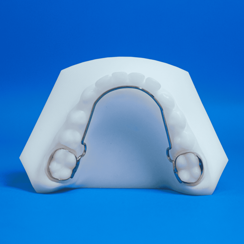 Lower Lingual Arch - Specialty Appliances