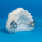 MARA Appliance: Crown-Based Mandibular Advancement for Class II