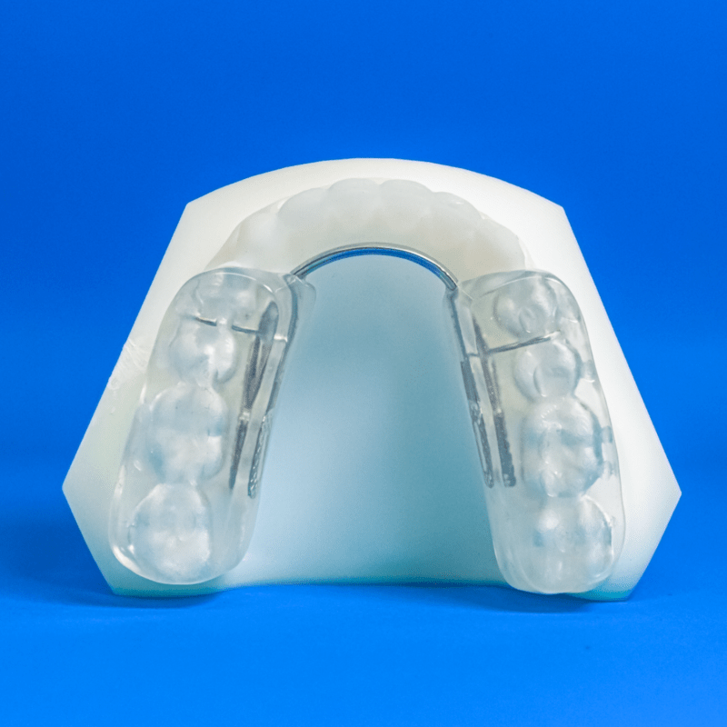 MORA Appliance: Mandibular Orthopedic Repositioning Device