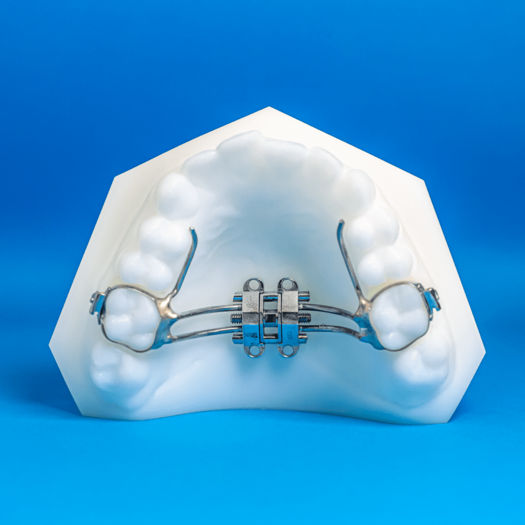 MSE Expander - Specialty Appliances