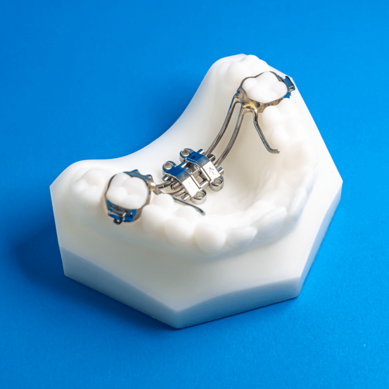 MSE Expander - Specialty Appliances