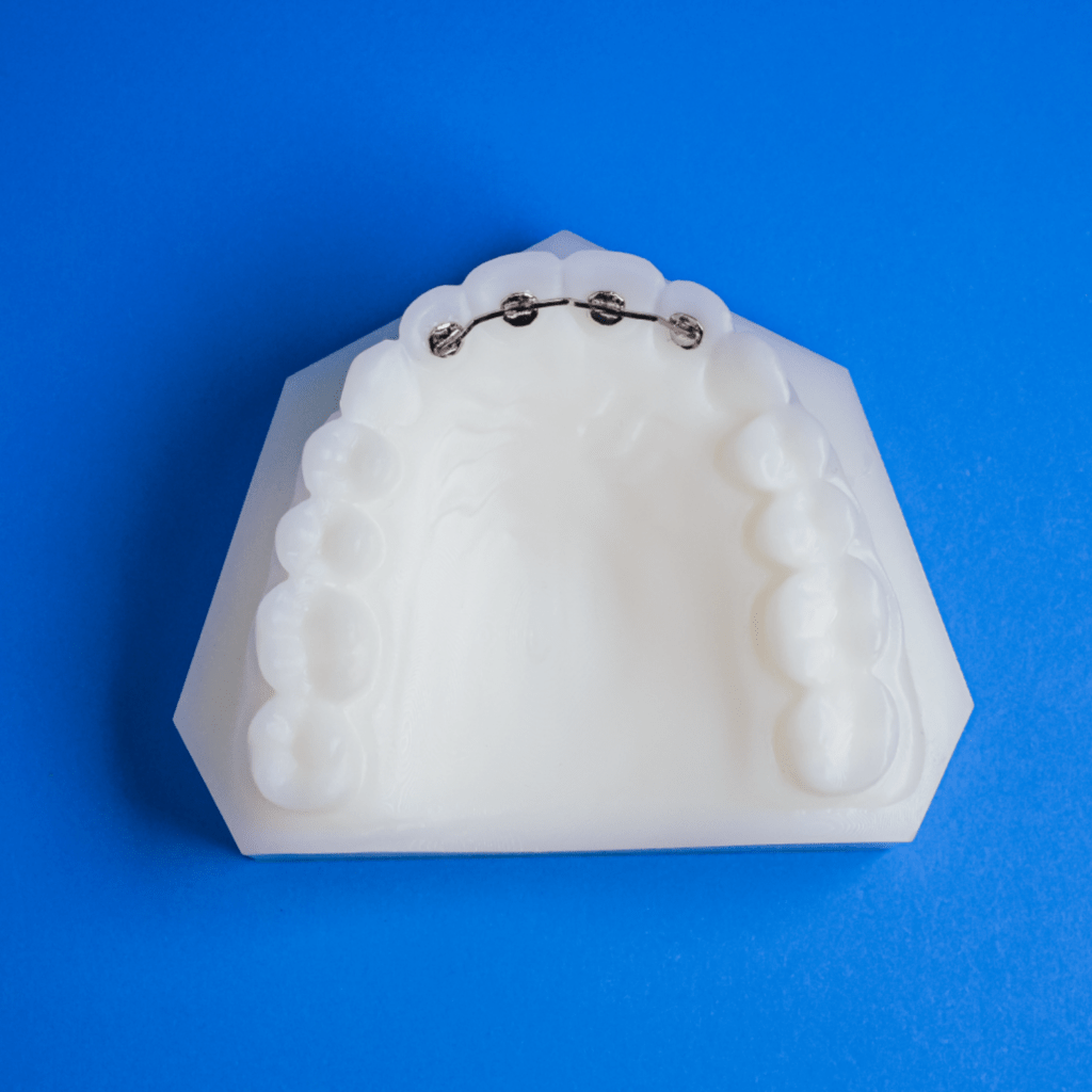Mesh Fixed Lingual Retainers - Specialty Appliances