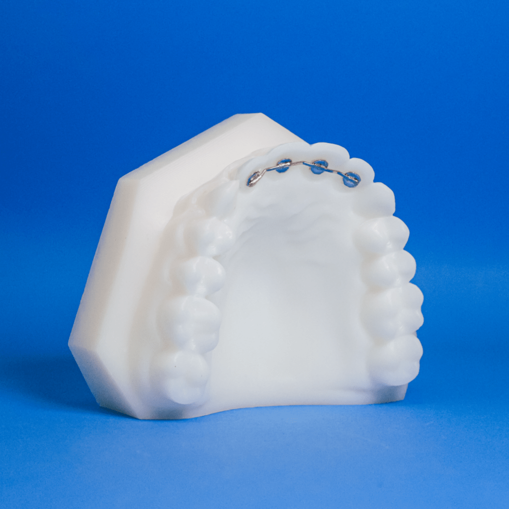 Mesh Fixed Lingual Retainers - Specialty Appliances