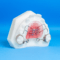 Pendex Appliance: Molar Distalization and Arch Expansion
