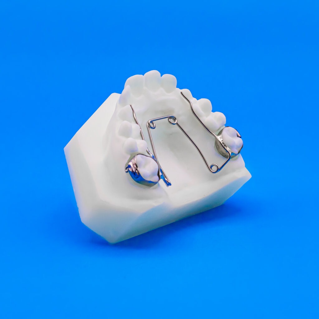 Quad Helix: Fixed Upper Arch Expansion Appliance