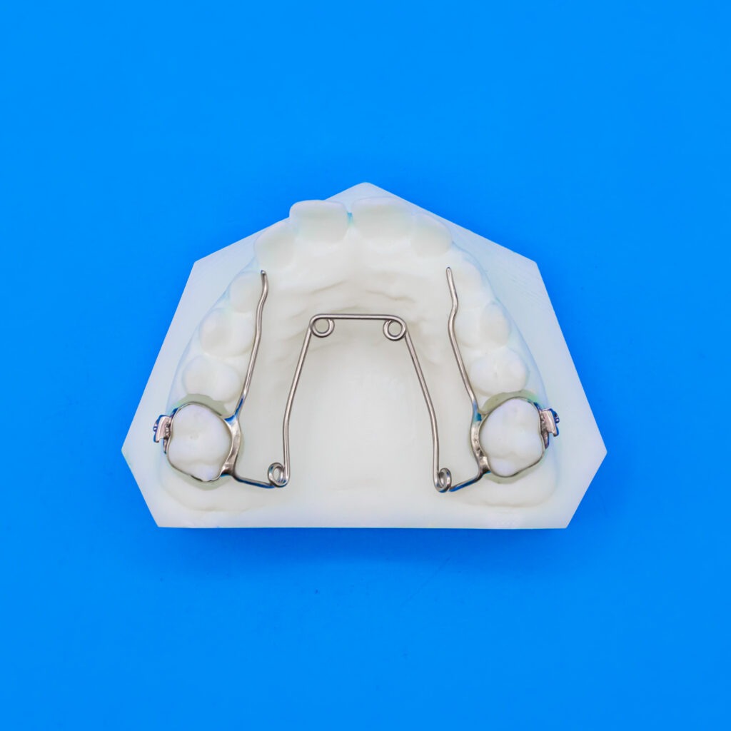 Upper Quad Helix - Specialty Appliances