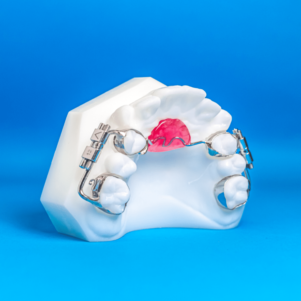 Rapid Molar Distalizer - Specialty Appliances
