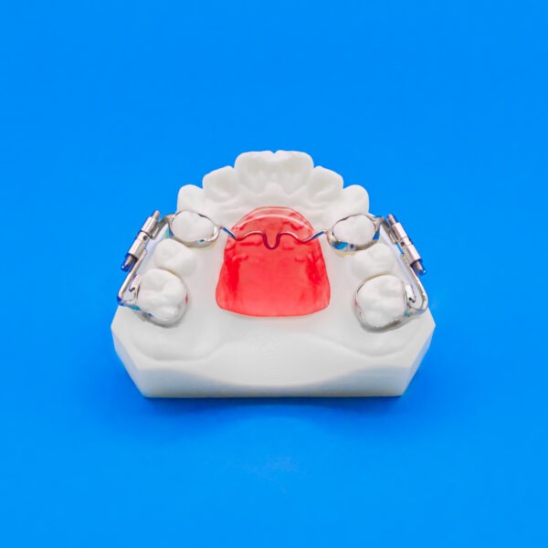 Rapid Molar Distalizer - Specialty Appliances