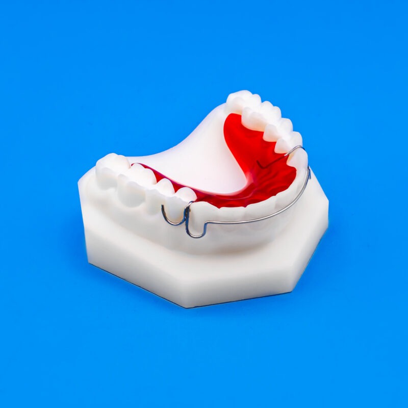 Orthodontic Appliances: Custom Lab-Fabricated Designs