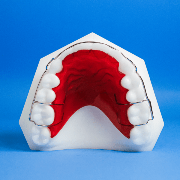 Soldered Labial Bow - Specialty Appliances