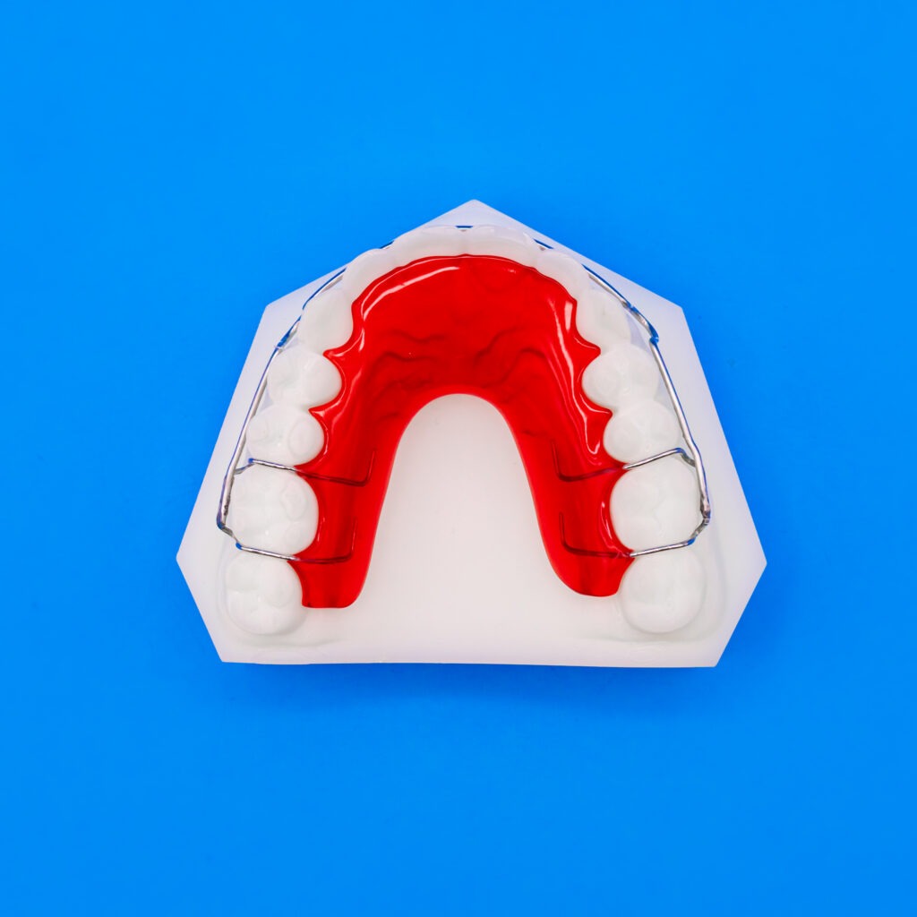 Soldered Labial Bow - Specialty Appliances