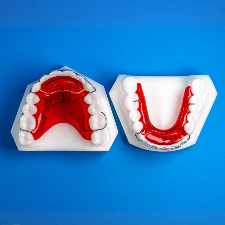 Spring Hawley - Specialty Appliances