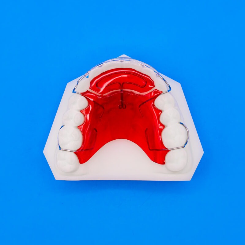 Spring Hawley Retainer: Active Anterior Tooth Movement