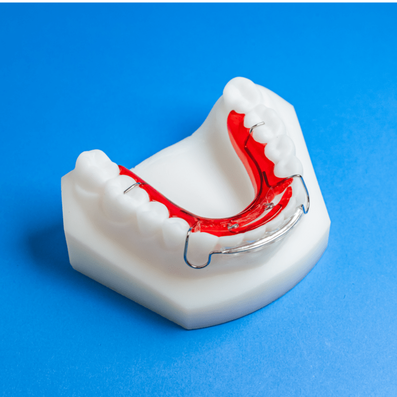 "Super" Modified Spring Retainer - Specialty Appliances