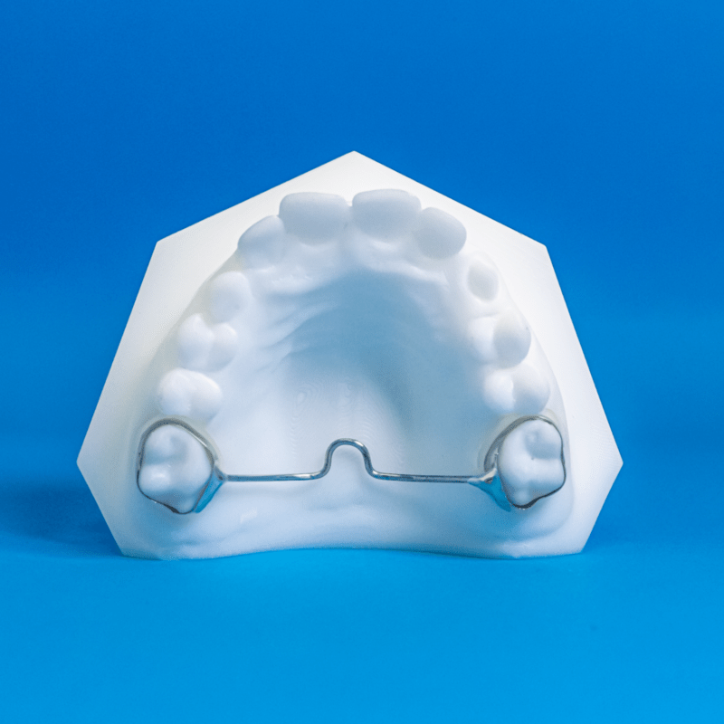 Transpalatal Arch - Specialty Appliances