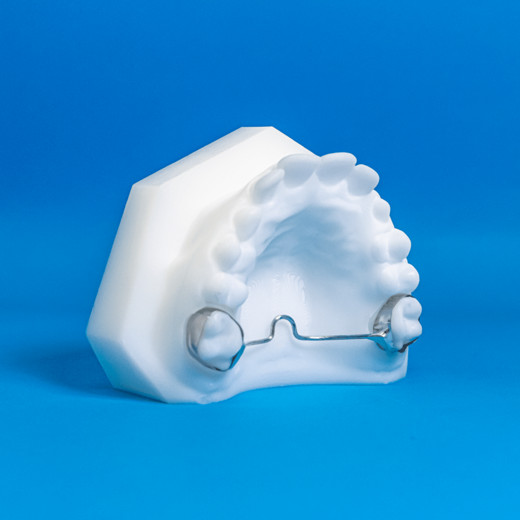 Transpalatal Arch (TPA): Custom Molar Anchorage Appliance