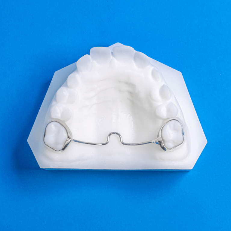 Transpalatal Arch - Specialty Appliances