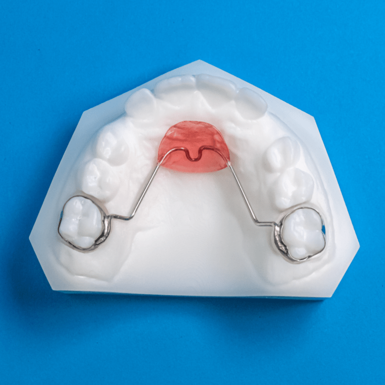 Upper Nance Appliance - Specialty Appliances