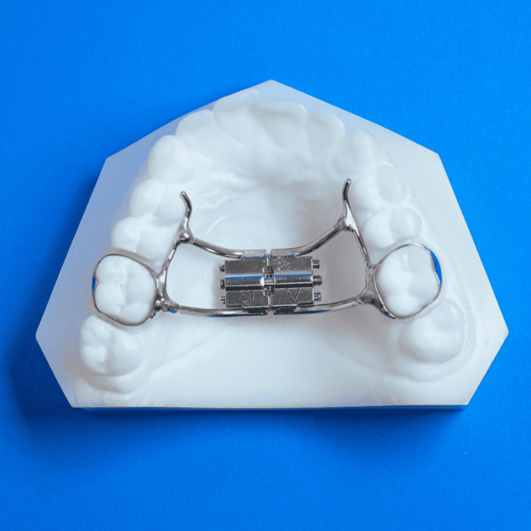 Upper RPE - Specialty Appliances