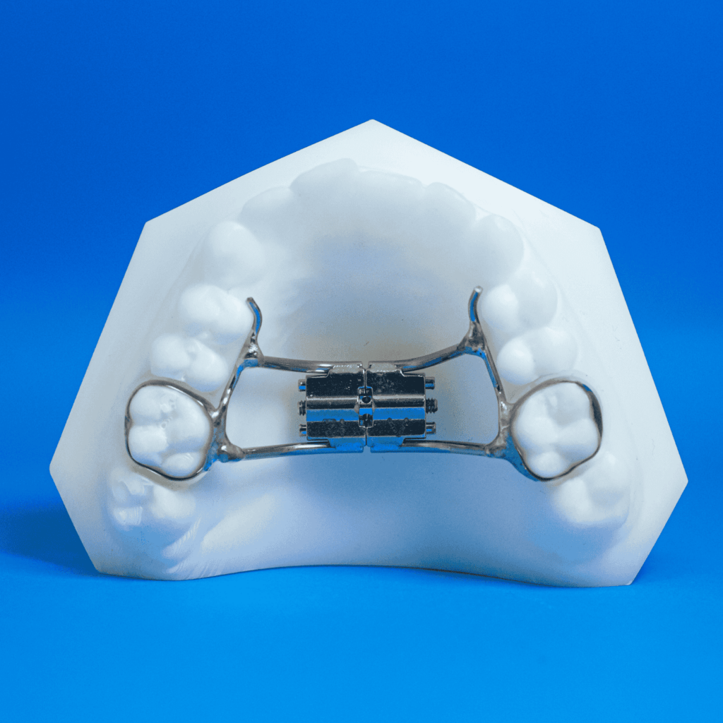 Upper RPE - Specialty Appliances