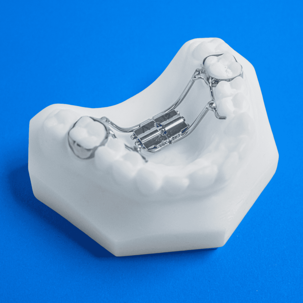 Upper RPE - Specialty Appliances