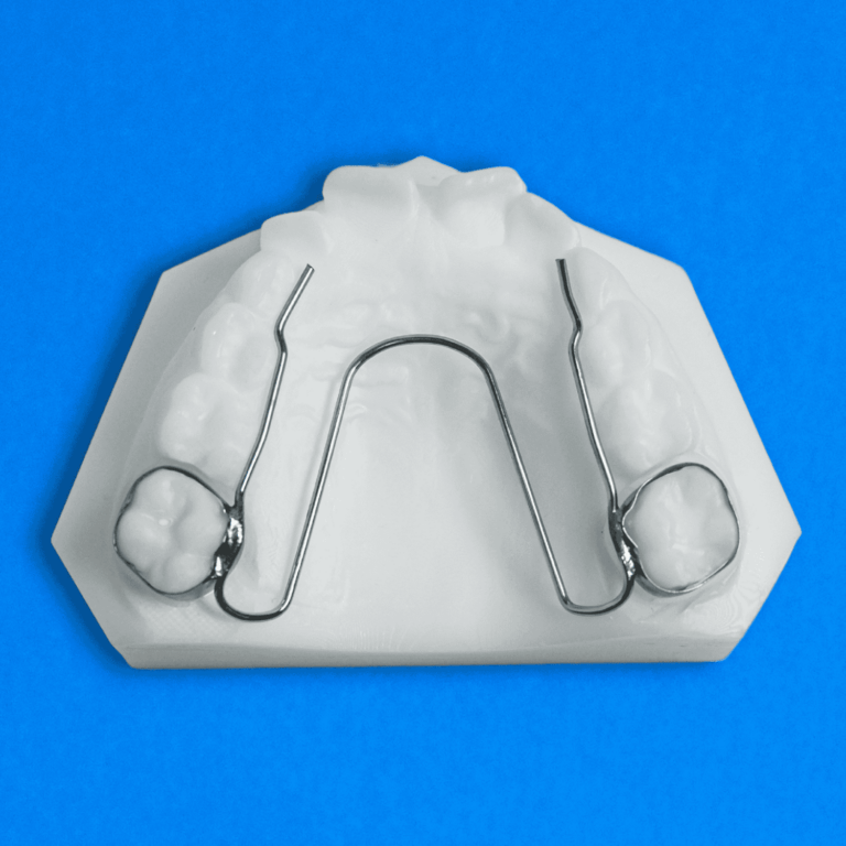 Transpalatal Arch - Specialty Appliances