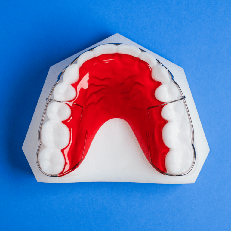 Wraparound Hawley - Specialty Appliances