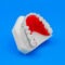 Wraparound Hawley Retainer: Continuous Labial Bow Design