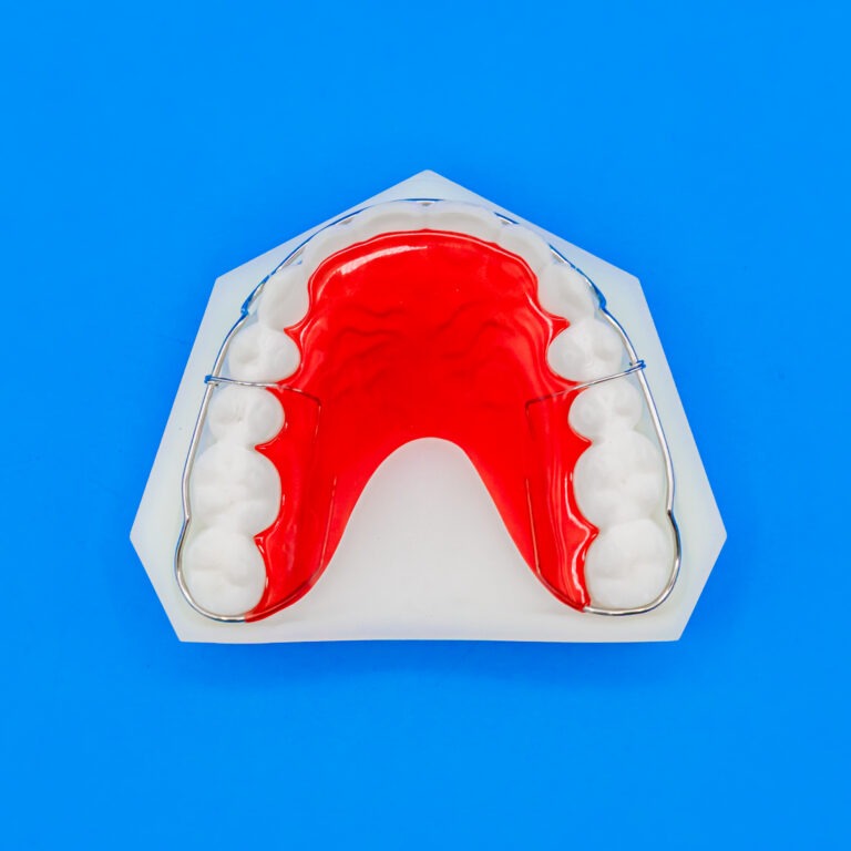 Wraparound Hawley Retainer: Continuous Labial Bow Design