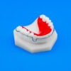 Wraparound Hawley Retainer: Continuous Labial Bow Design