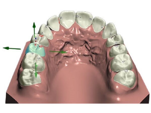 Vinyl Positioner - Specialty Appliances