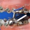 MARA Appliance: Crown-Based Mandibular Advancement for Class II