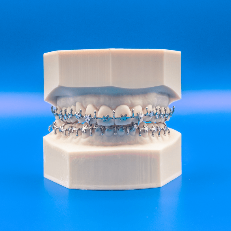 TADs and Surgical Wires Archives - Specialty Appliances